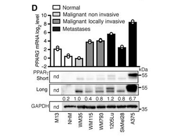 WM115 Viable Cells (WM115-01-0001) | Rockland